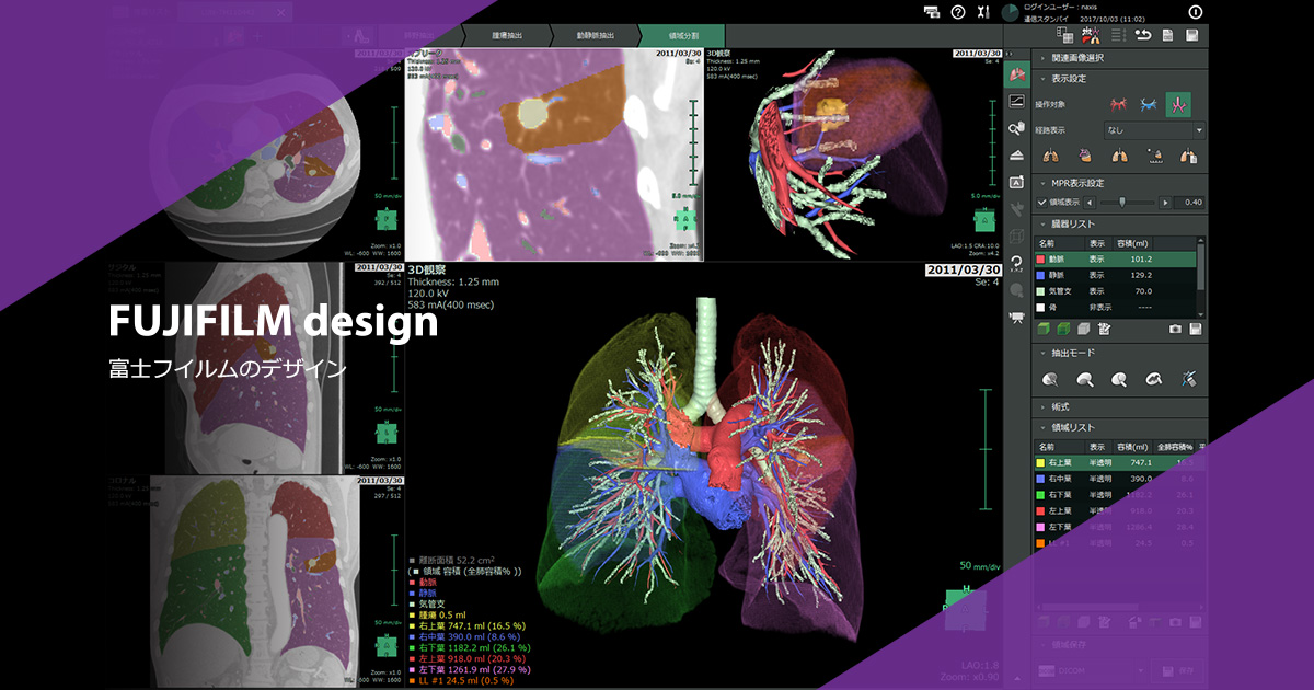 富士フイルムのデザイン（3次元画像解析システムボリュームアナライザー SYNAPSE VINCENT） | 富士フイルム